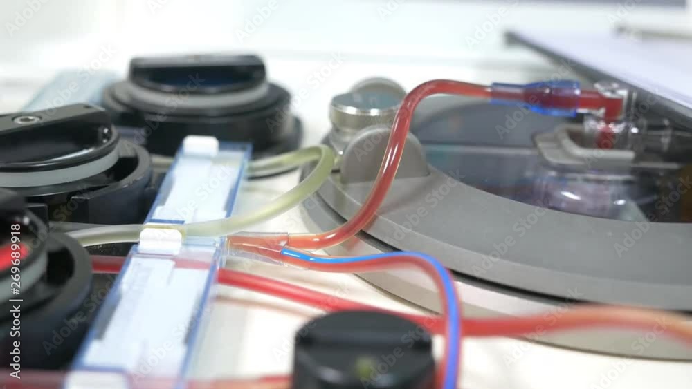 platelets blood separation machine working,Platelet donation, Blood ...