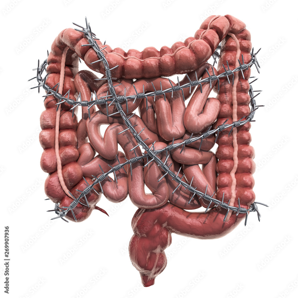 Abdominal pain concept. Human intestines with barbed wire. 3D rendering ...