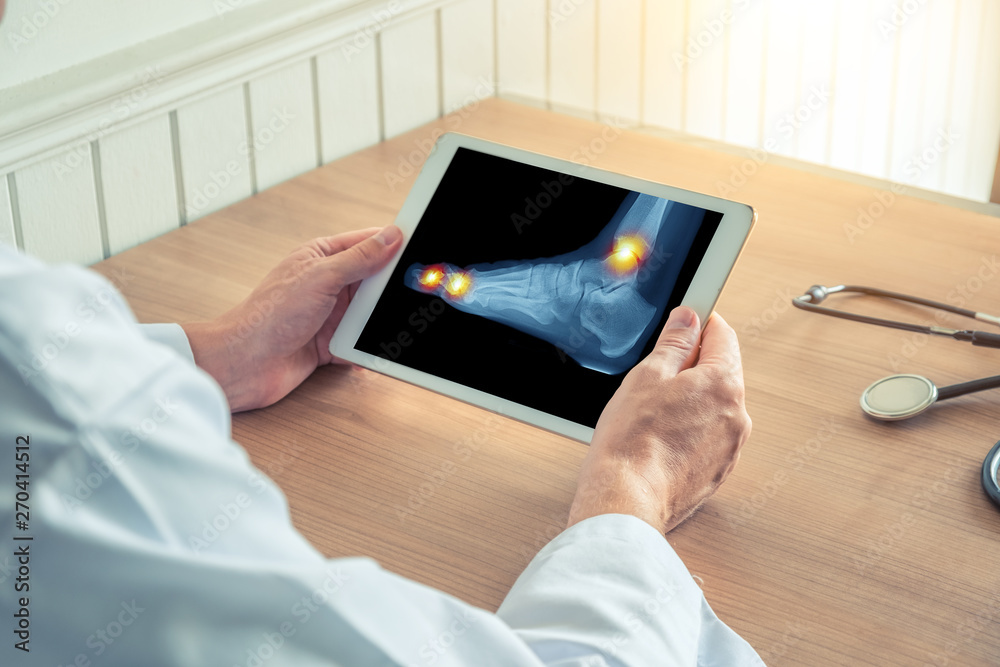 Doctor holding a digital tablet with x-ray and pain on the ankle and ...