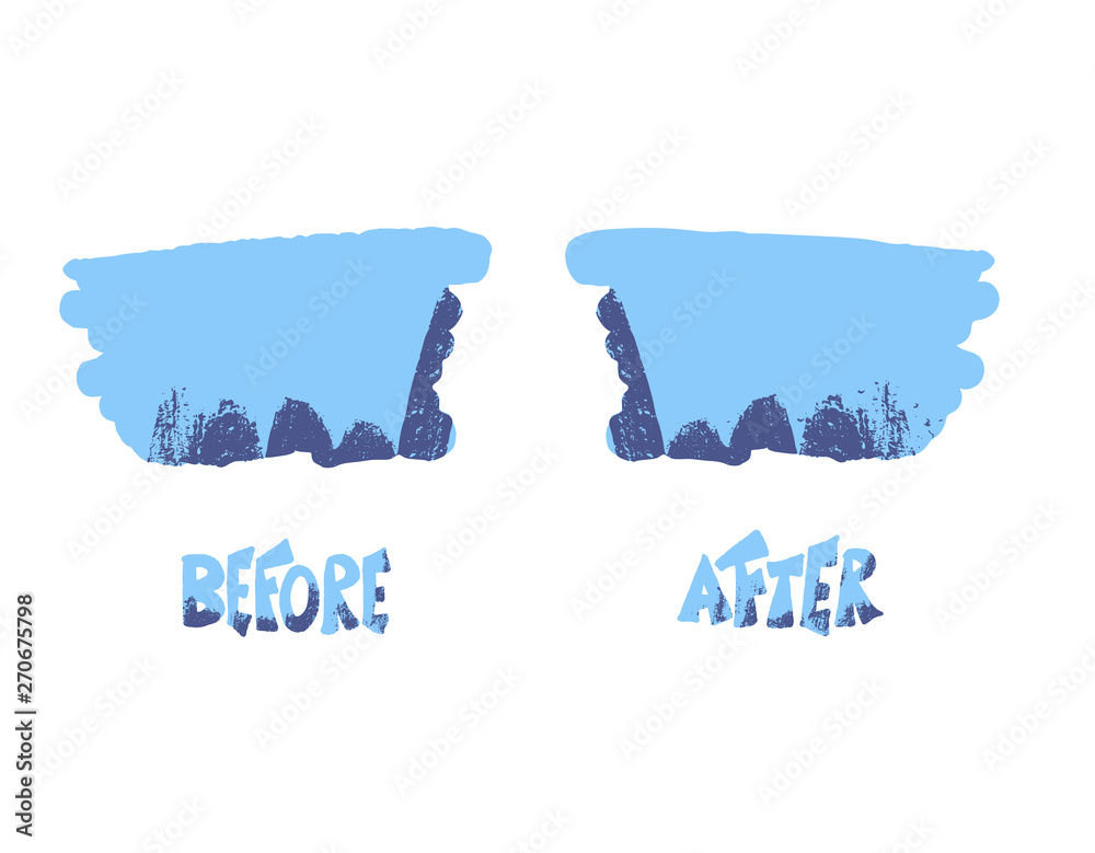 Before and after template. Vector screen elements. Stock Vector | Adobe ...