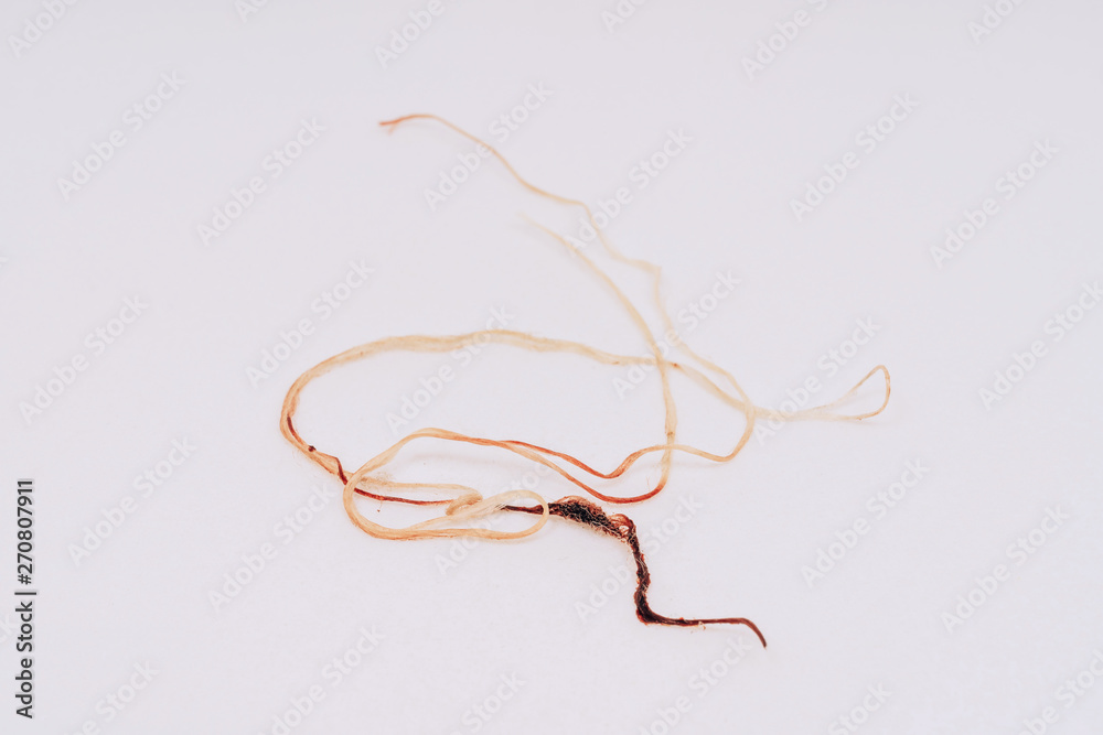 Dental floss with blood on a white background. Periodontal disease in ...