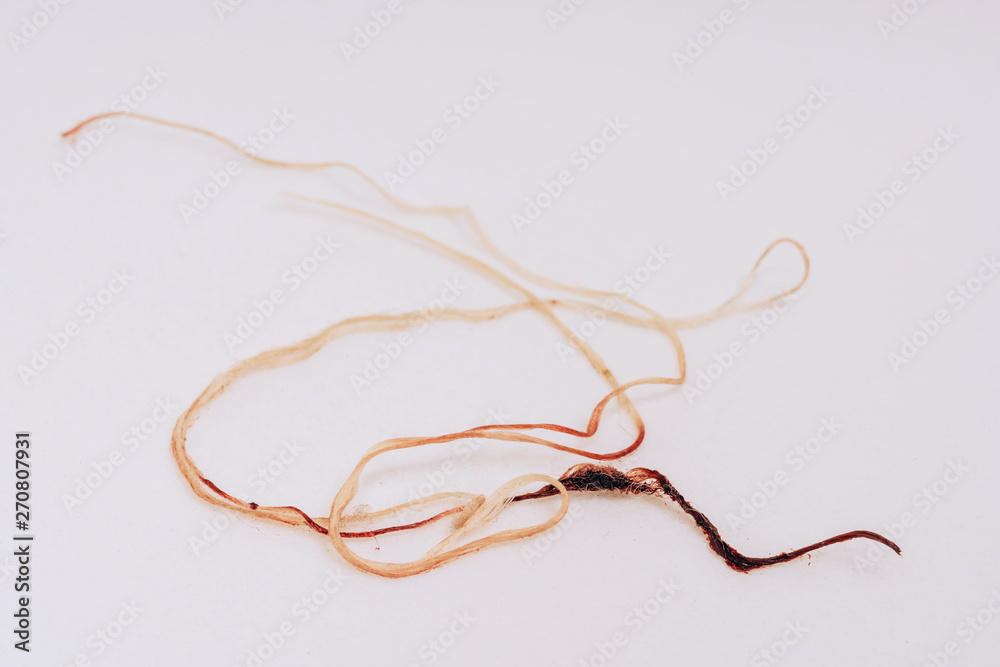 Dental floss with blood on a white background. Periodontal disease in ...