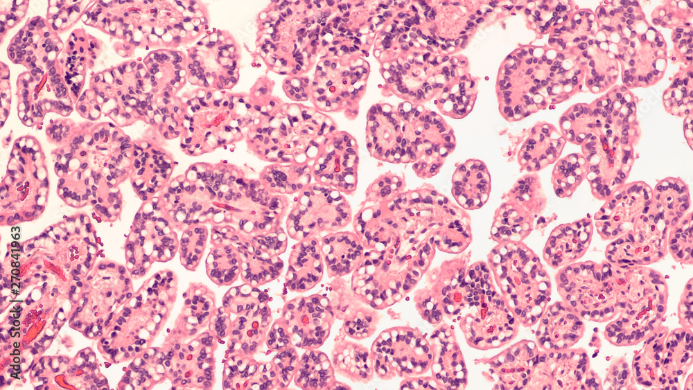 Choroid Plexus Histology