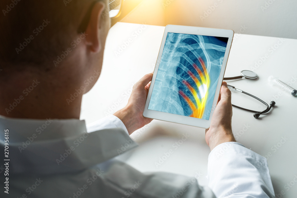 Doctor holding a digital tablet with x-ray of chest. Pain on the ribs ...