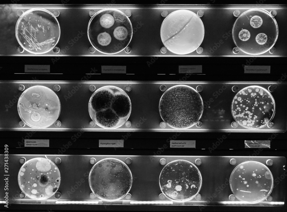 different samples with kinds of bacterias living at common household ...