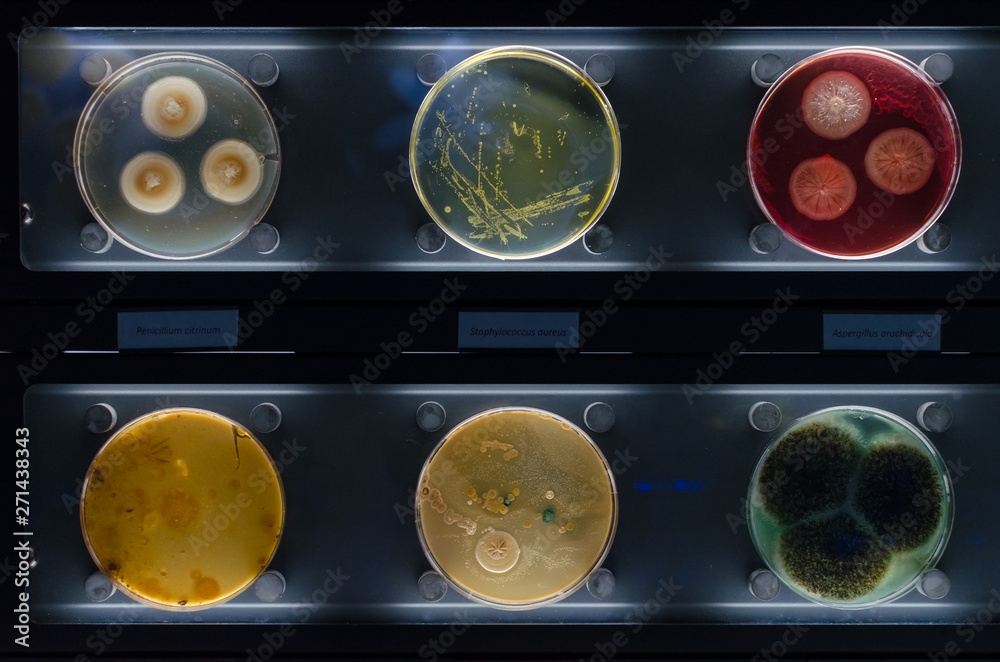 different samples with kinds of bacterias living at common household ...