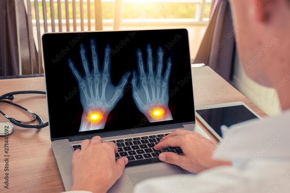 Doctor watching a x-ray of hands with pain in the wrists. Radiology and ...