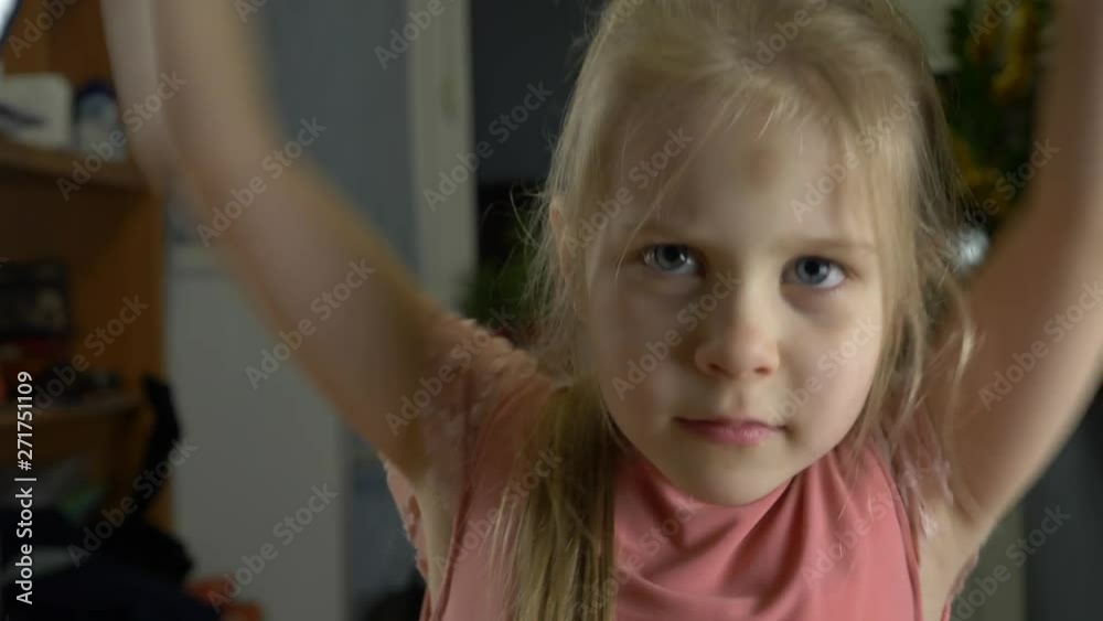 Little blue-eyed child with blond hair and yellow-black bruise on ...