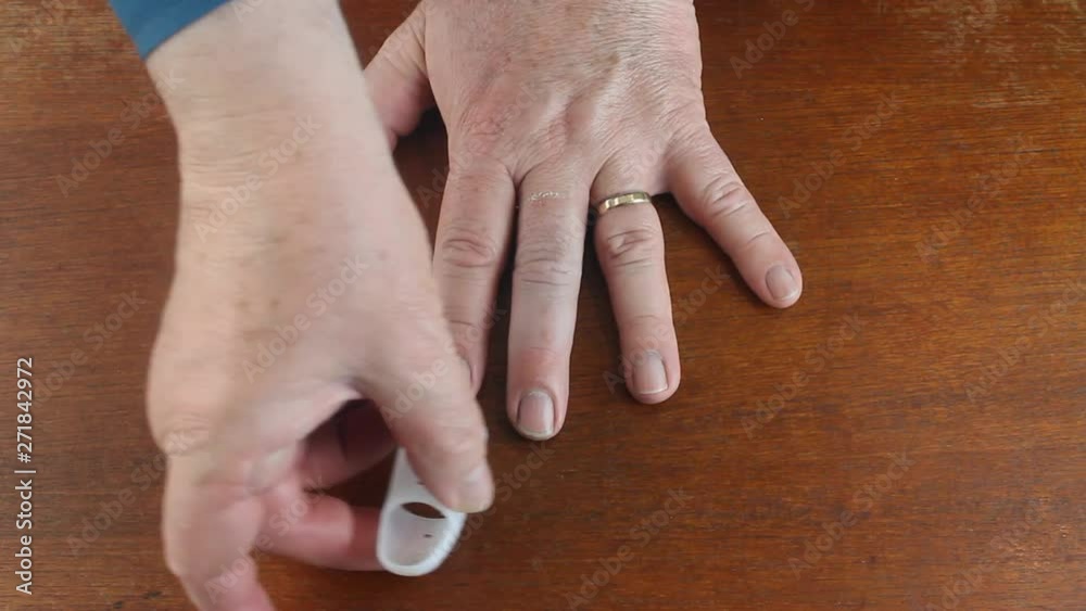 Vidéo Stock Hand of a man with a mallet finger injury, a ruptured ...