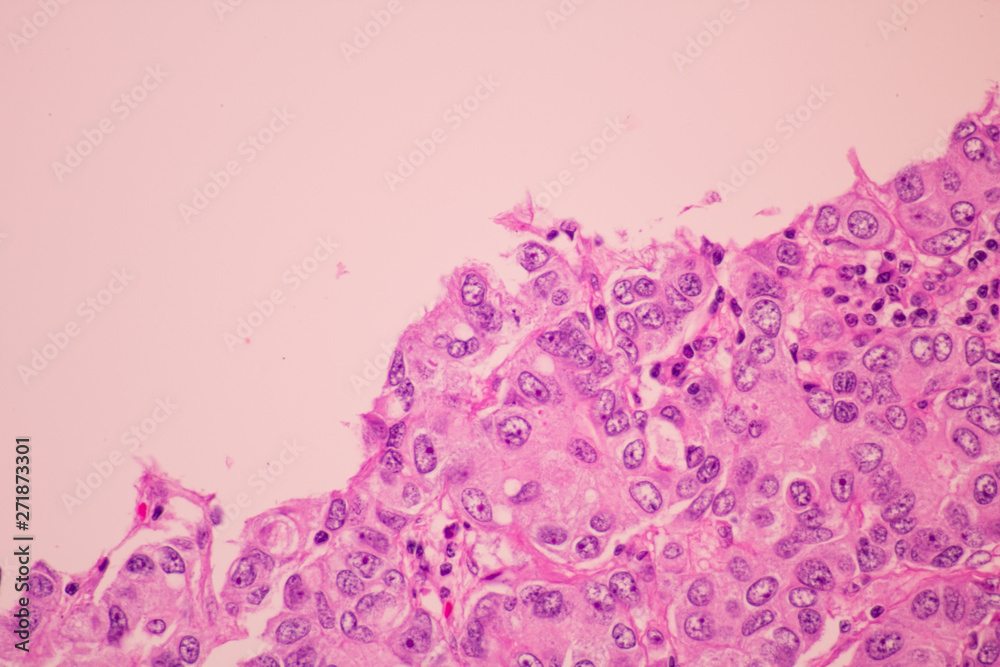 View in microscopic of pathology cross section tissue ductal cell ...