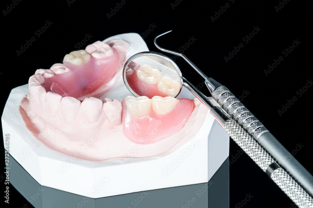 Close up, Artificial removable partial denture or temporary partial ...
