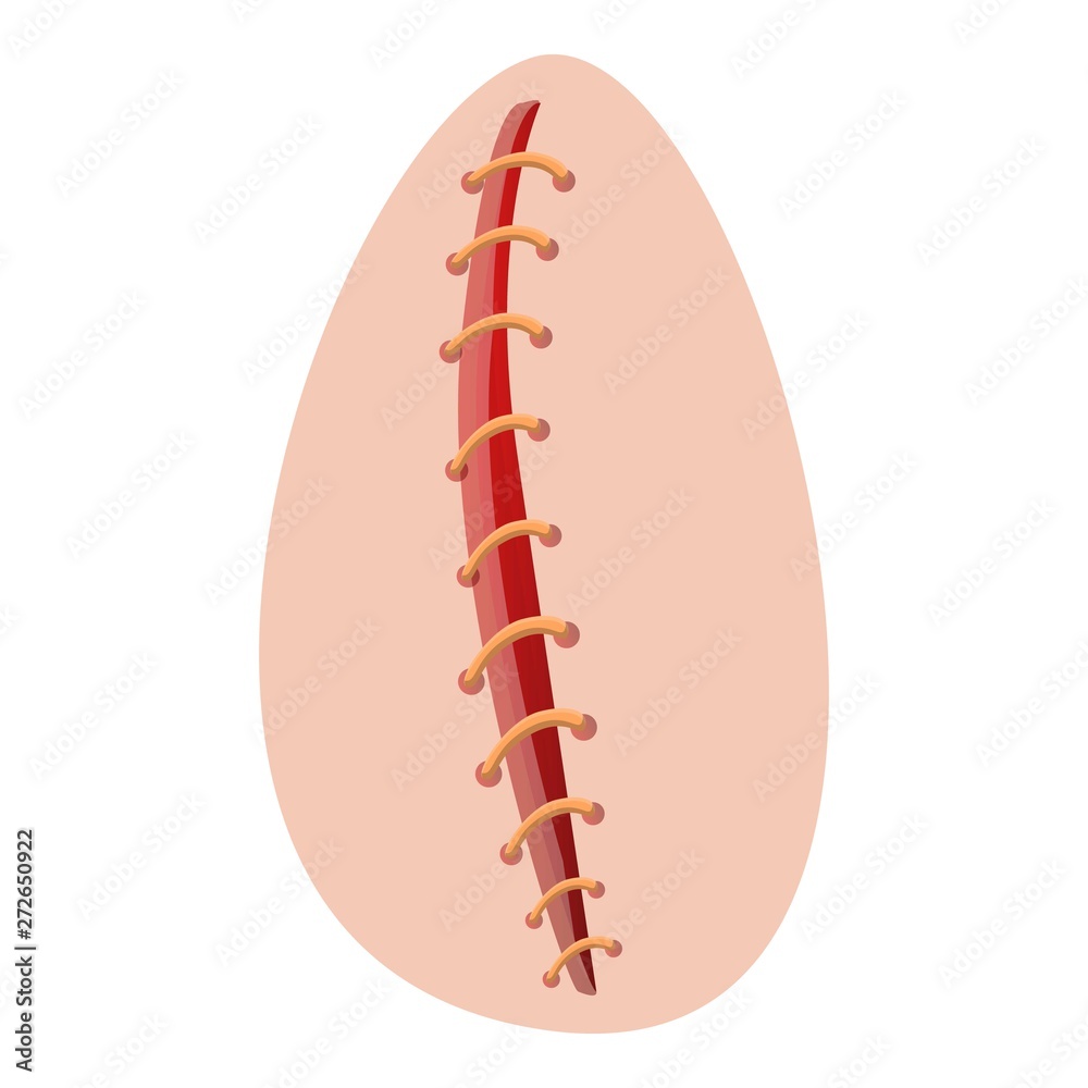 Medical suture icon. Cartoon of medical suture vector icon for web ...