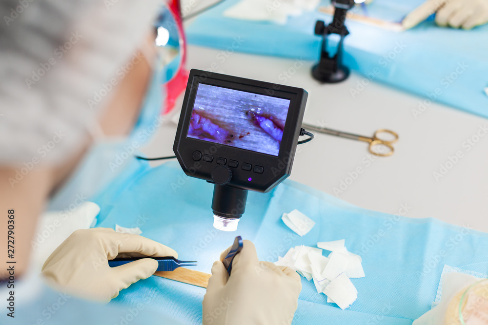 The doctor under the microscope recalculates the hair follicles ...