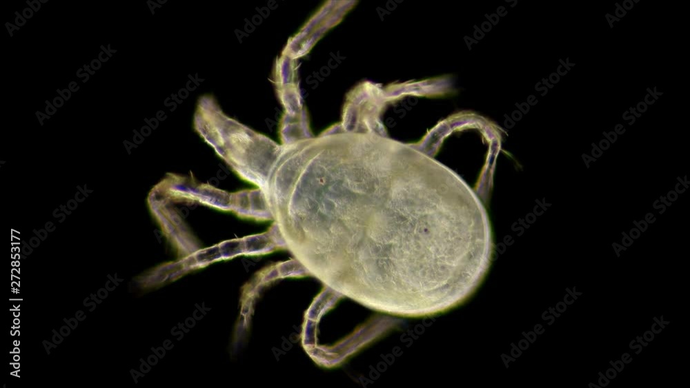 Acari, a saprophage mite, under a microscope, perhaps from the order of ...