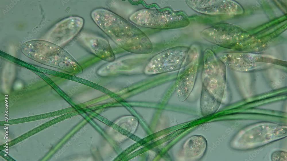 infusorium Paramcium under a microscope, movement of a colony of ...