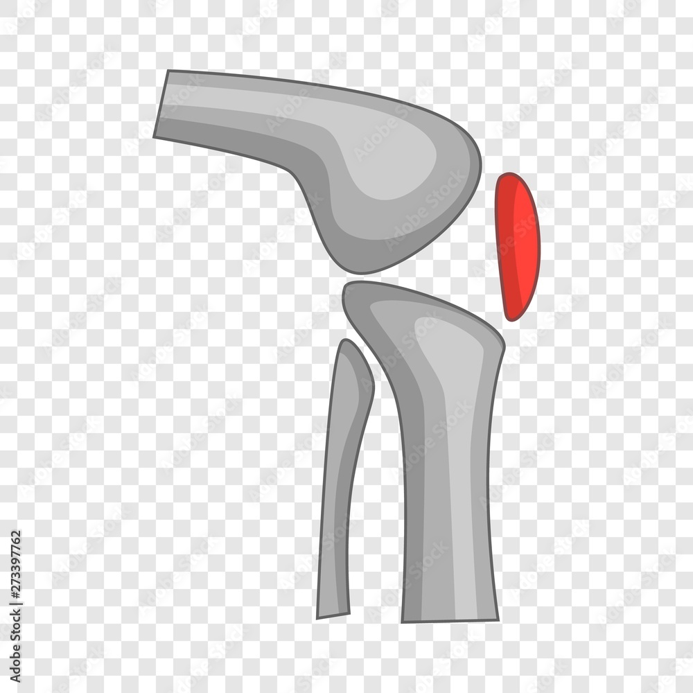 Knee replacement implant icon. Cartoon illustration of knee replacement ...