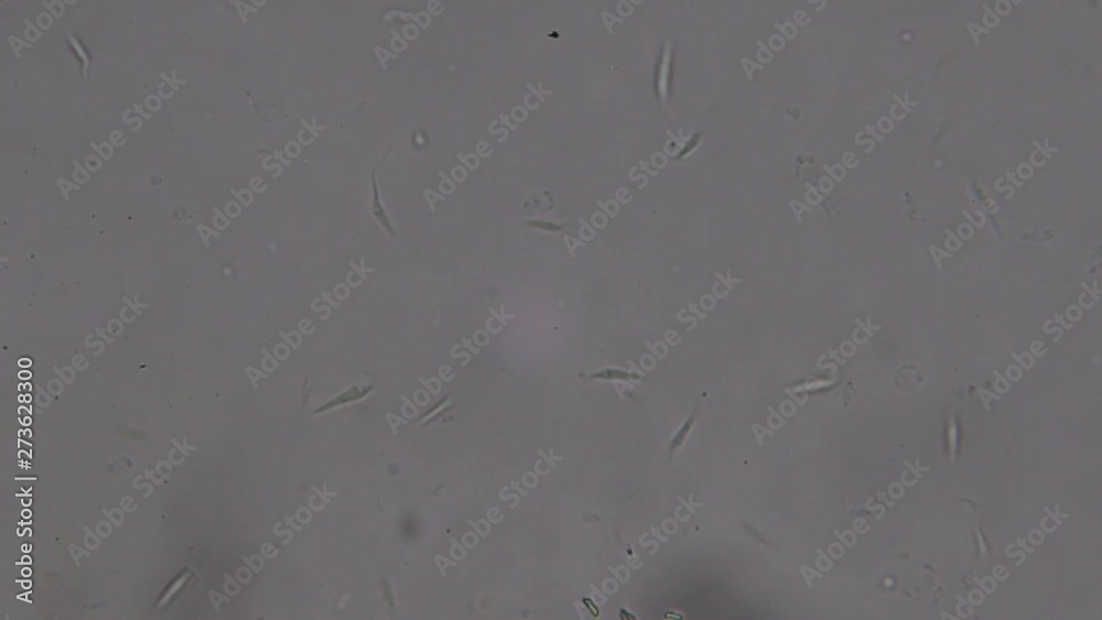 Trypanosoma cruzi microscope view; human diseases Stock ビデオ | Adobe Stock