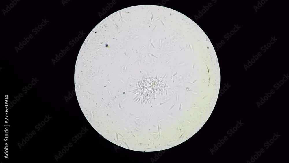 Trypanosoma cruzi microscope view; human diseases Stock-Video | Adobe Stock