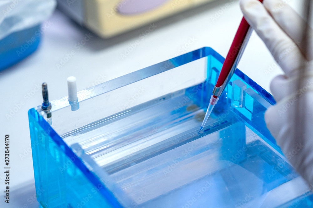 Molecular technique gel electrophoresis for DNA sample method decrypt ...