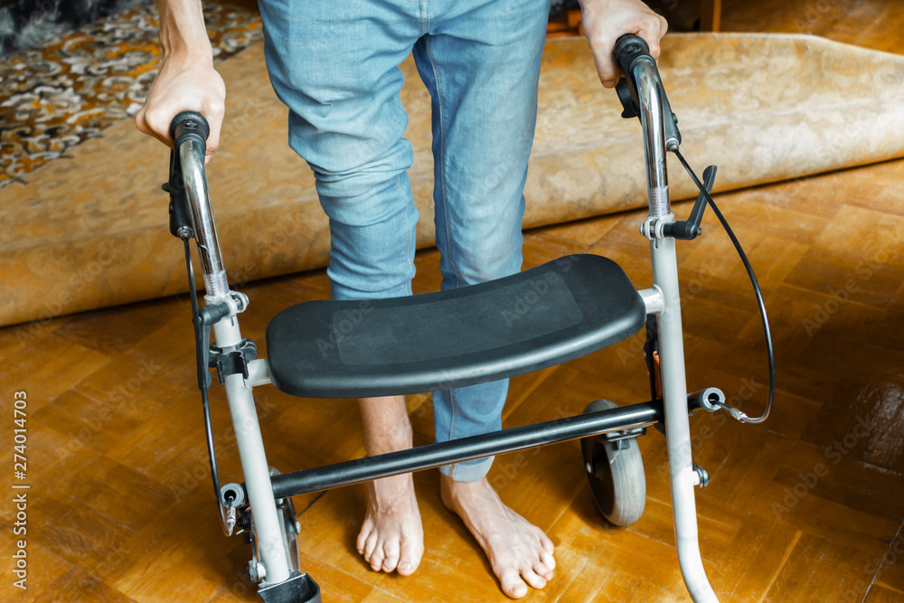 young guy with a broken and deformed leg is standing with a walker on ...