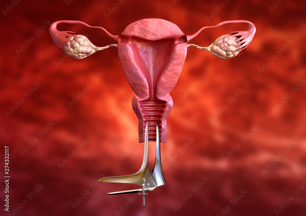 Pap smear is a gynecological examination of cervical cytology performed ...