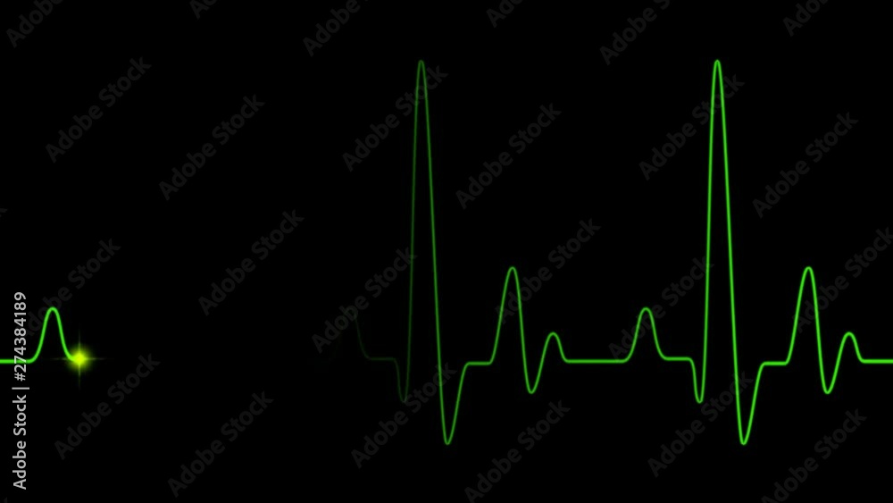 Green heart pulse graphic line on black, healthcare medical animation ...