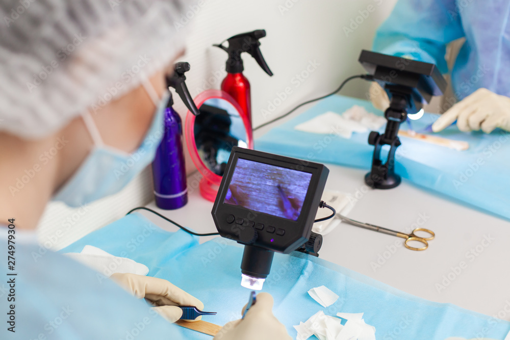 The doctor under the microscope recalculates the hair follicles ...