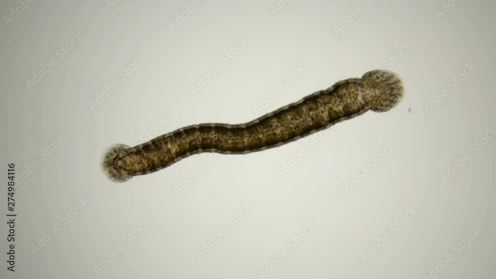 Vidéo Stock Leech. Fish leech Piscicola under the microscope. A ...