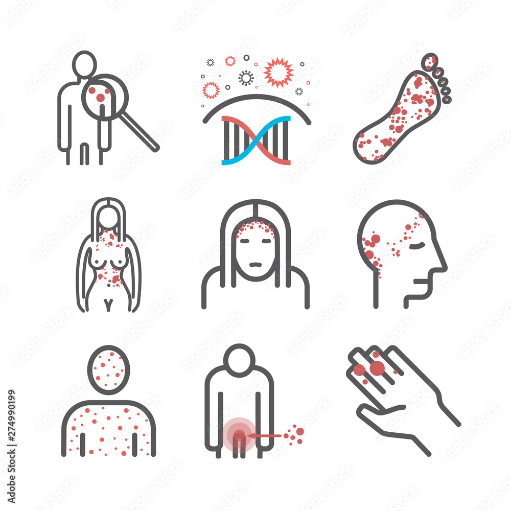 Psoriasis. Symptoms, Treatment. Line icons set. Vector signs for web ...