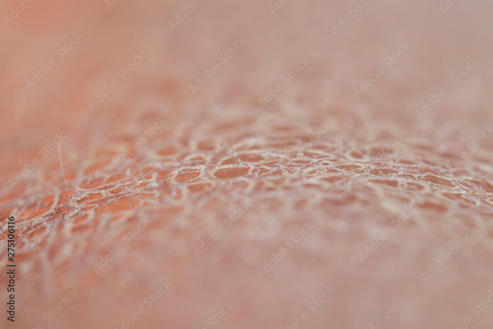 background texture of dry, unhealthy skin is covered with small and ...