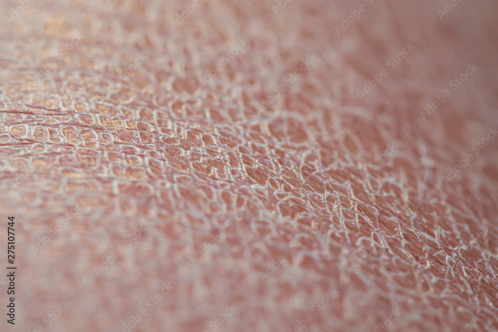 background texture of dry, unhealthy skin is covered with small and ...