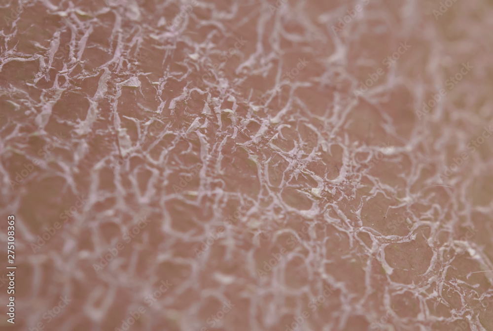 background of dry unhealthy skin texture close-up covered with small ...