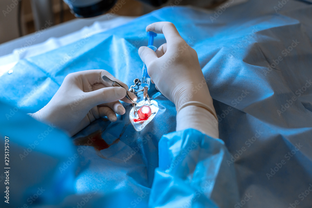 A professional ophthalmologist performs eye surgery with a microscope ...