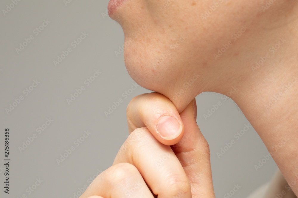 A close-up and side profile view of a young Caucasian woman pinching ...