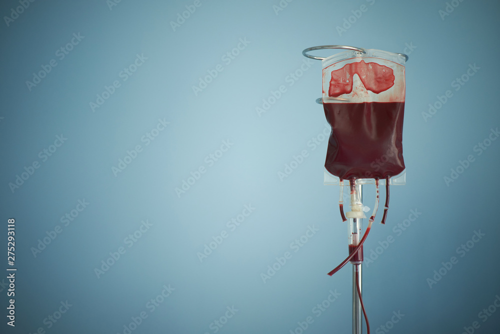 transfusion of blood, bag with red blood cells on stand. Blue ...