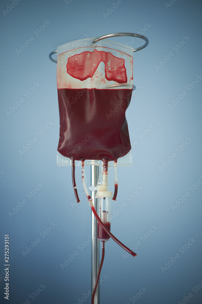 transfusion of blood, bag with red blood cells on stand. Blue ...