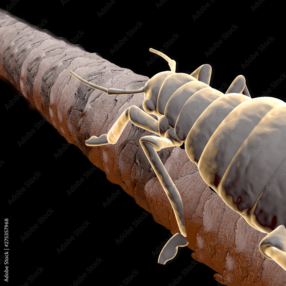 Ilustrace „Lice on hair close up as a medical problem concept as ...