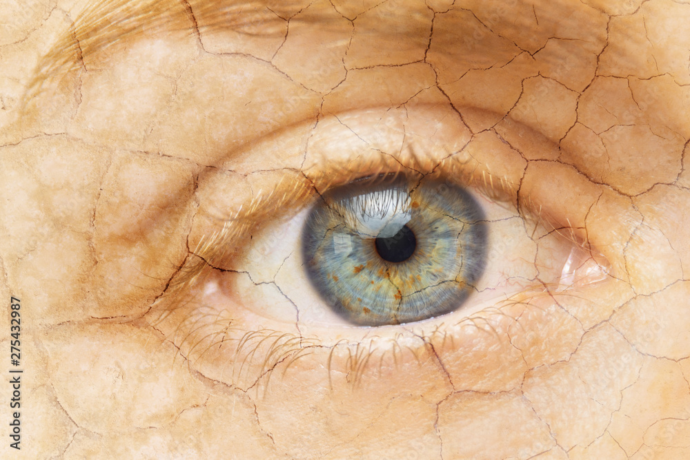 Cracked Skin. Closeup of a female eye with cracked skin. Aging process ...
