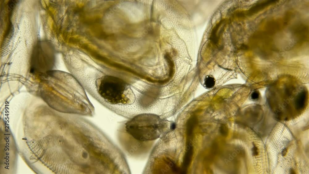 Zooplankton under the microscope. A colony of different plankton ...