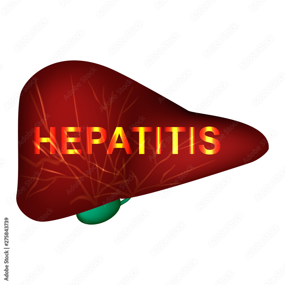 Hepatitis A, B, C, D, E, F, G. World Hepatitis Day. Infographics ...