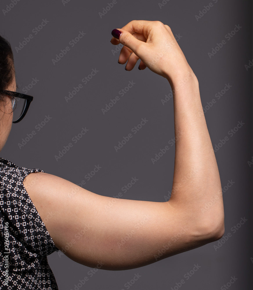 A closeup view on the arm of a young Caucasian woman with sagging fat ...