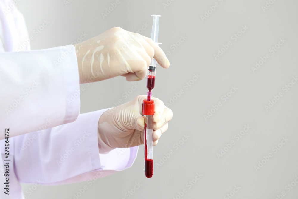 Doctor hand holding blood collection tubes in hematology laboratory ...
