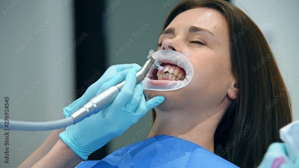 Woman Dentist Brushing Her Teeth To Patient Before Installing Braces ...