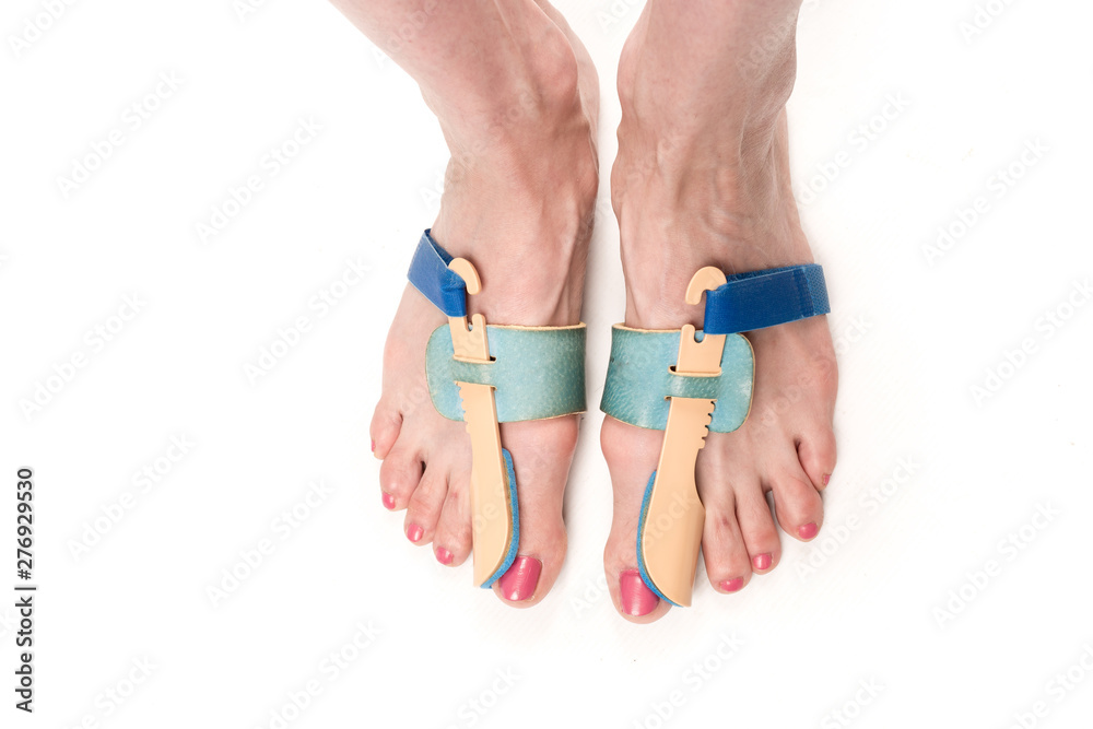 stabilizing orthosis for the correction of the big toe on the woman ...