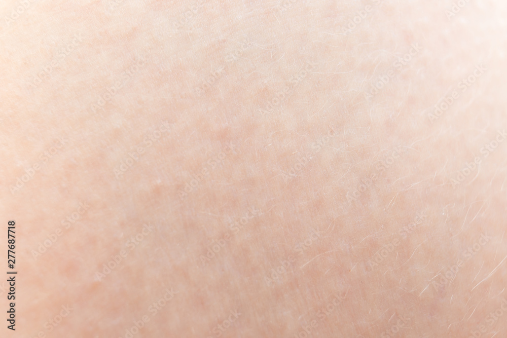Macro of human skin. Human skin texture Stock Photo | Adobe Stock