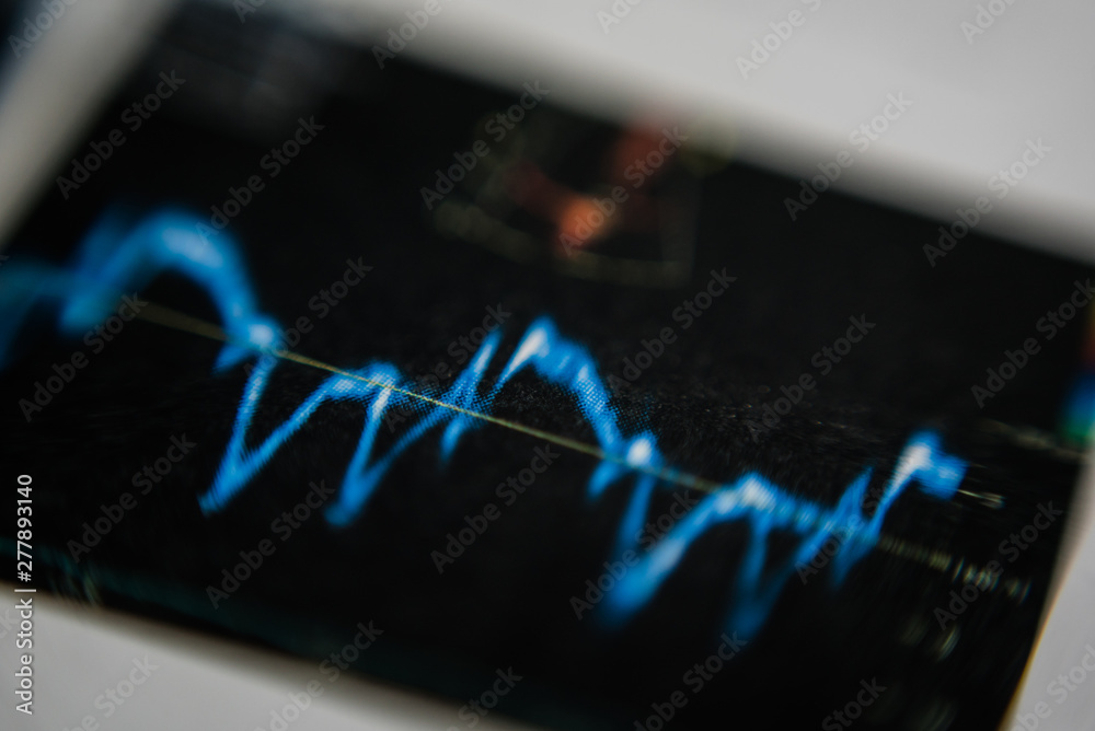 Echo display screen,Ultrasound screen. Echo-cardiogram ...