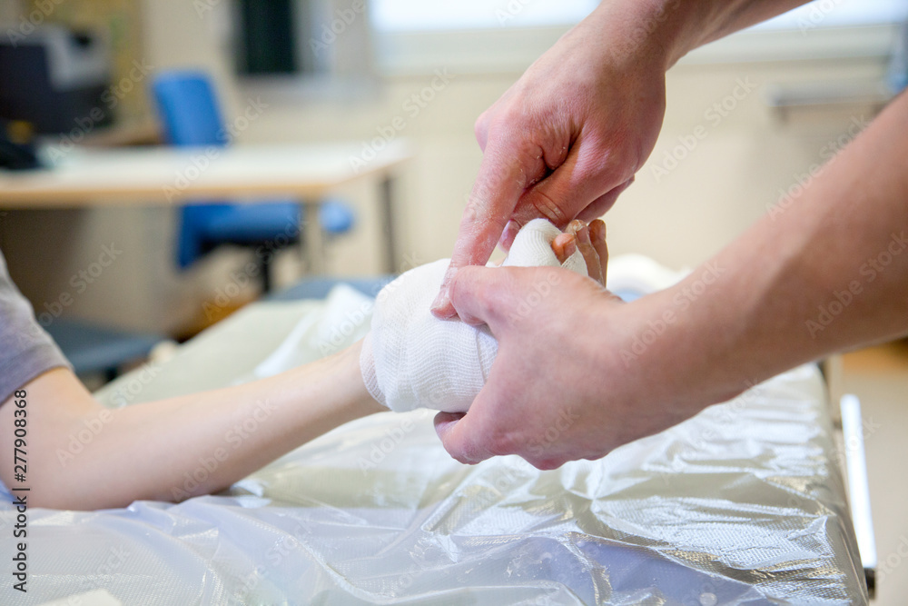 doctor bandaging plaster cast to kids broken hand bone in hospital ...