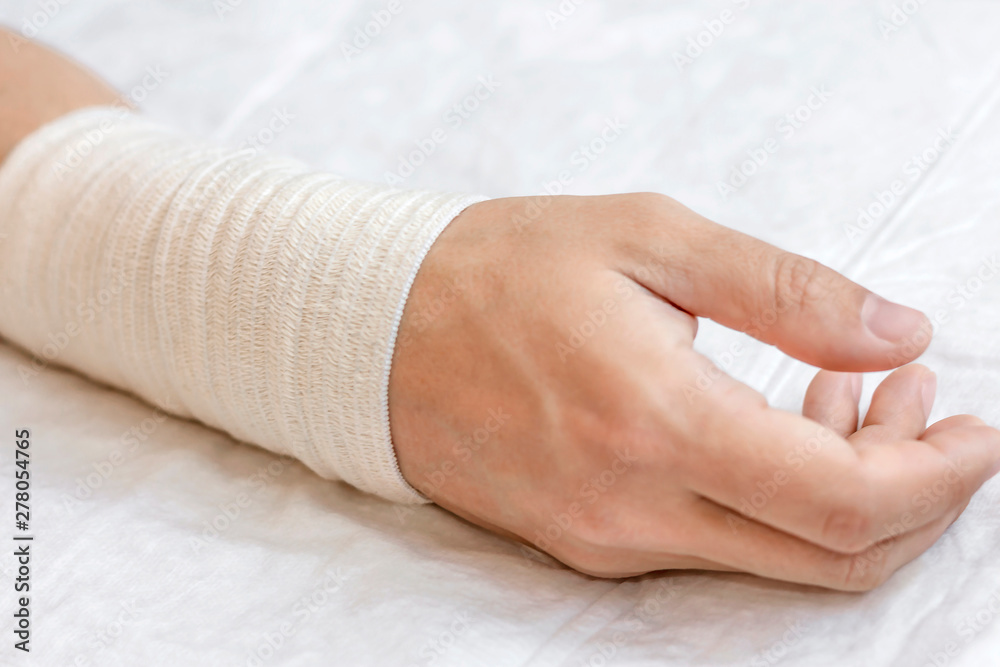 Man broken arm wrist with bandage in hospital office. Limb of patient ...