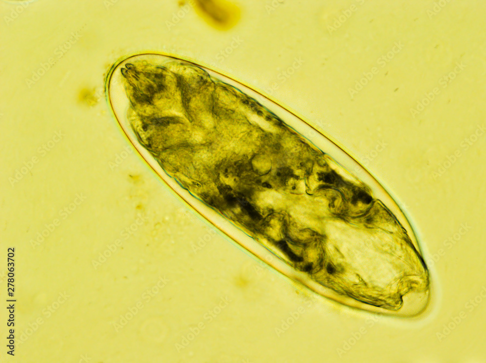flea egg with the larva inside under the microscope Stock Photo | Adobe ...