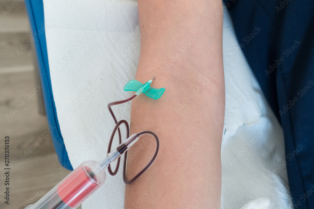 blood sampling performed with butterfly needle and vacutainer system ...